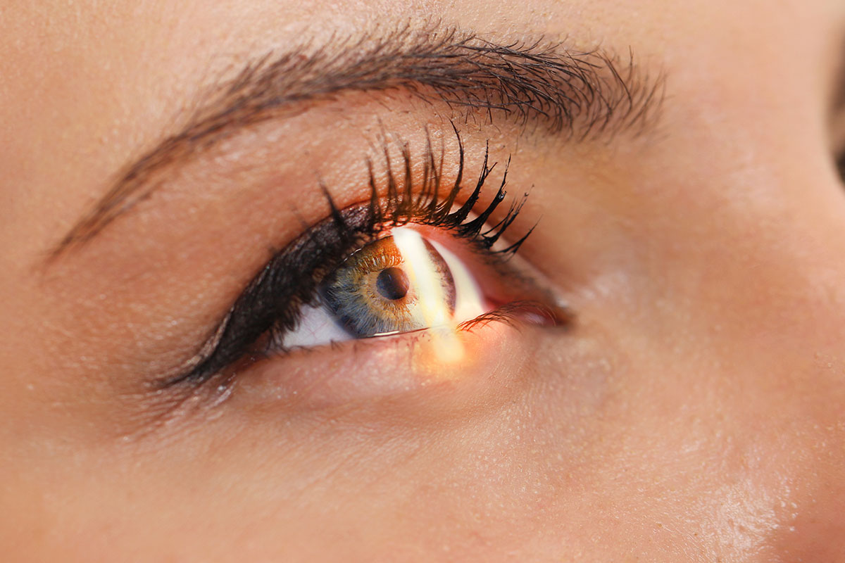 LASIK Bakersfield, CA | West Coast Eye Institute