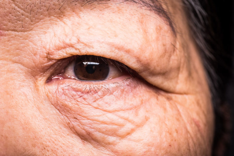 Intravitreal Injection | West Coast Eye Institute in Bakersfield, CA